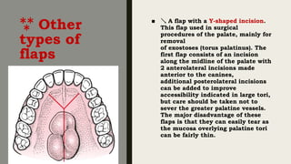 Principles of sutures and flap design ..pptx