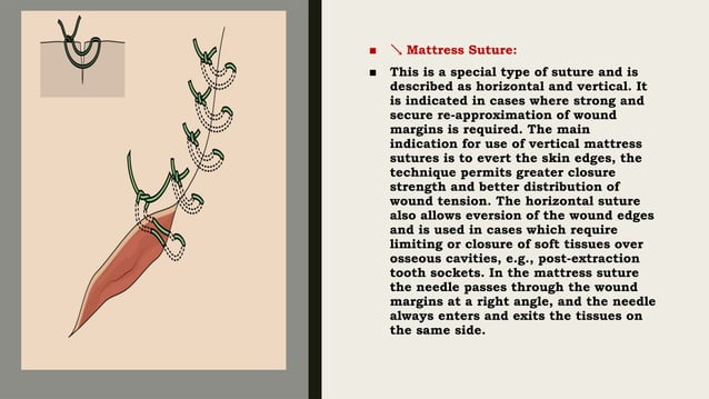 Principles of sutures and flap design ..pptx