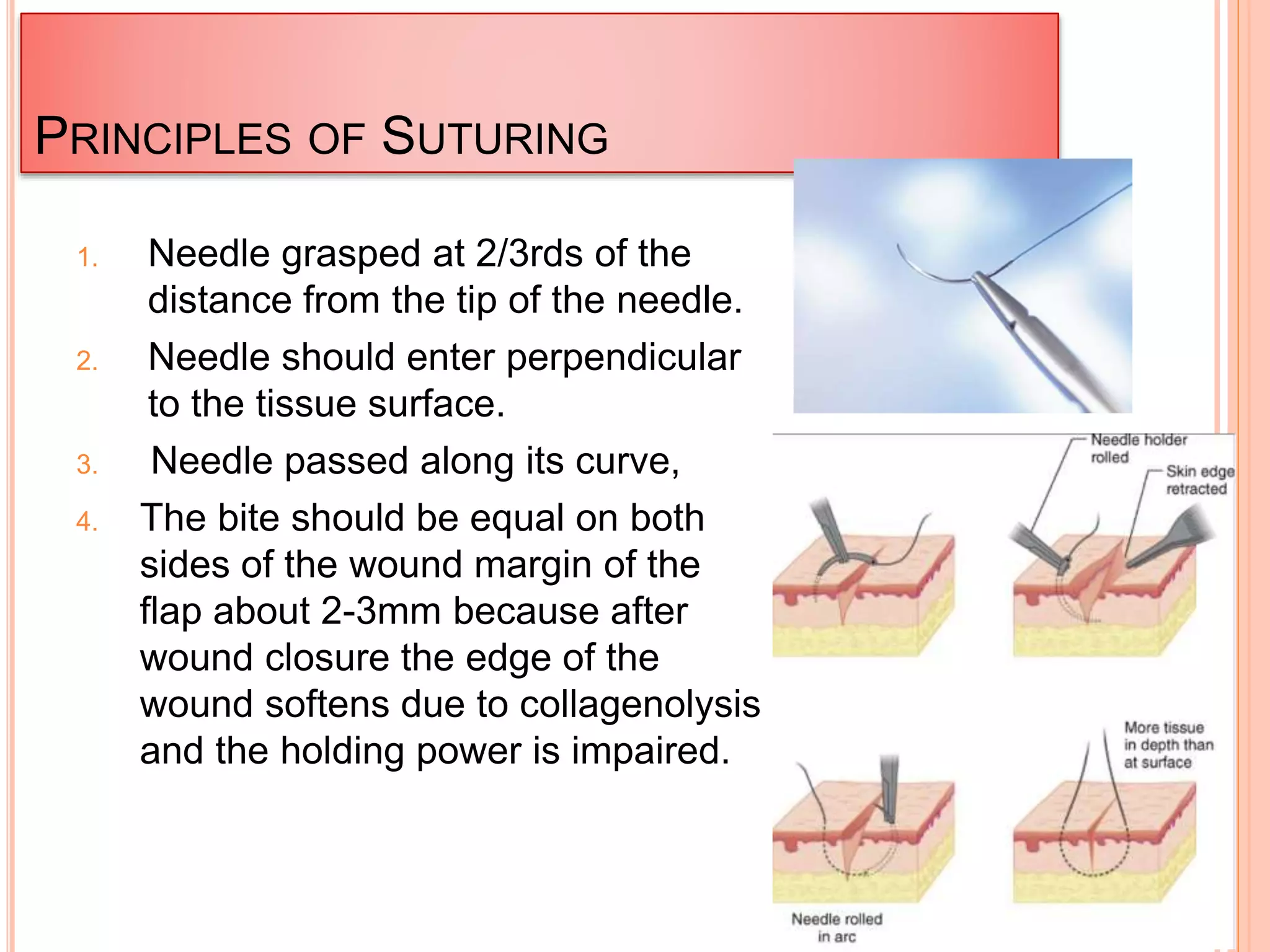 Principles of suturing in surgery | PPTX