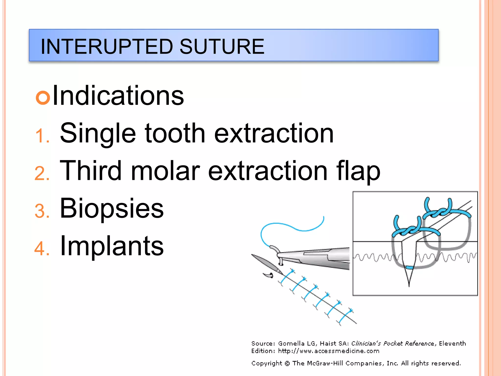 Principles of suturing in surgery | PPTX