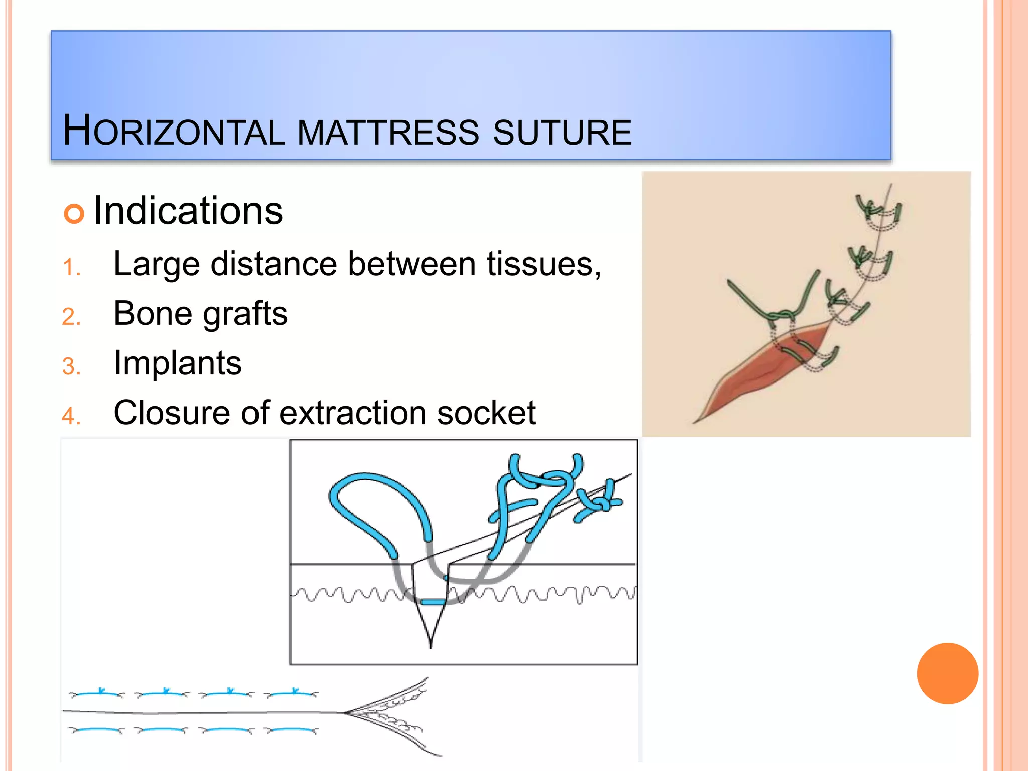 Principles of suturing in surgery | PPTX