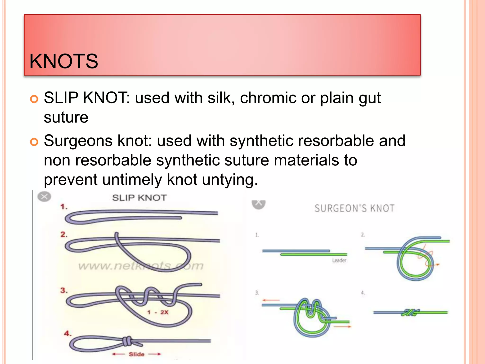 Principles of suturing in surgery | PPTX