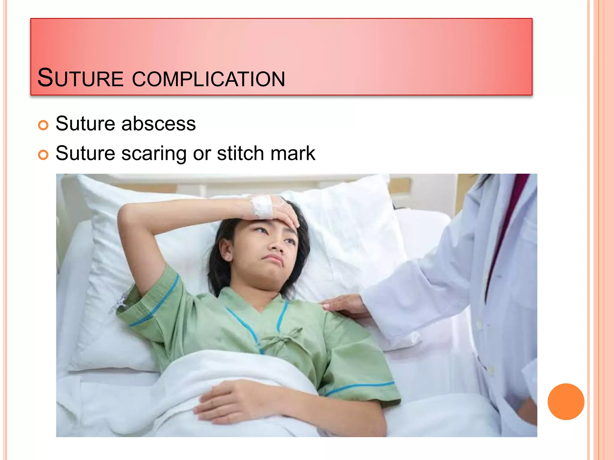 Principles of suturing in surgery | PPTX
