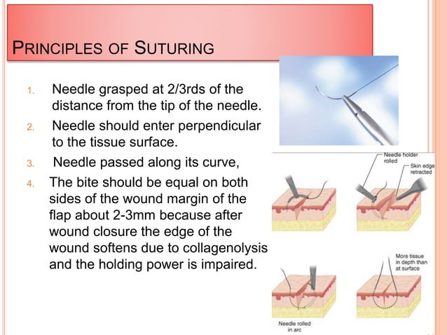 Principles of suturing in surgery | PPTX