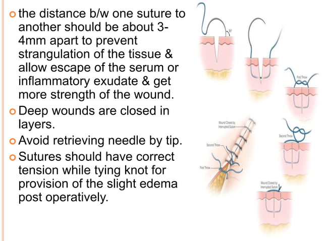 Principles of suturing in surgery | PPTX