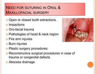 Principles of suturing in surgery | PPTX