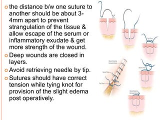 Principles of suturing in surgery | PPT