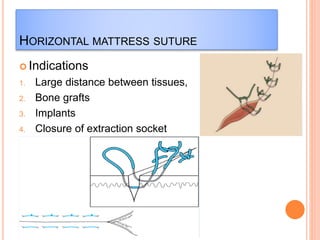 Principles of suturing in surgery | PPT