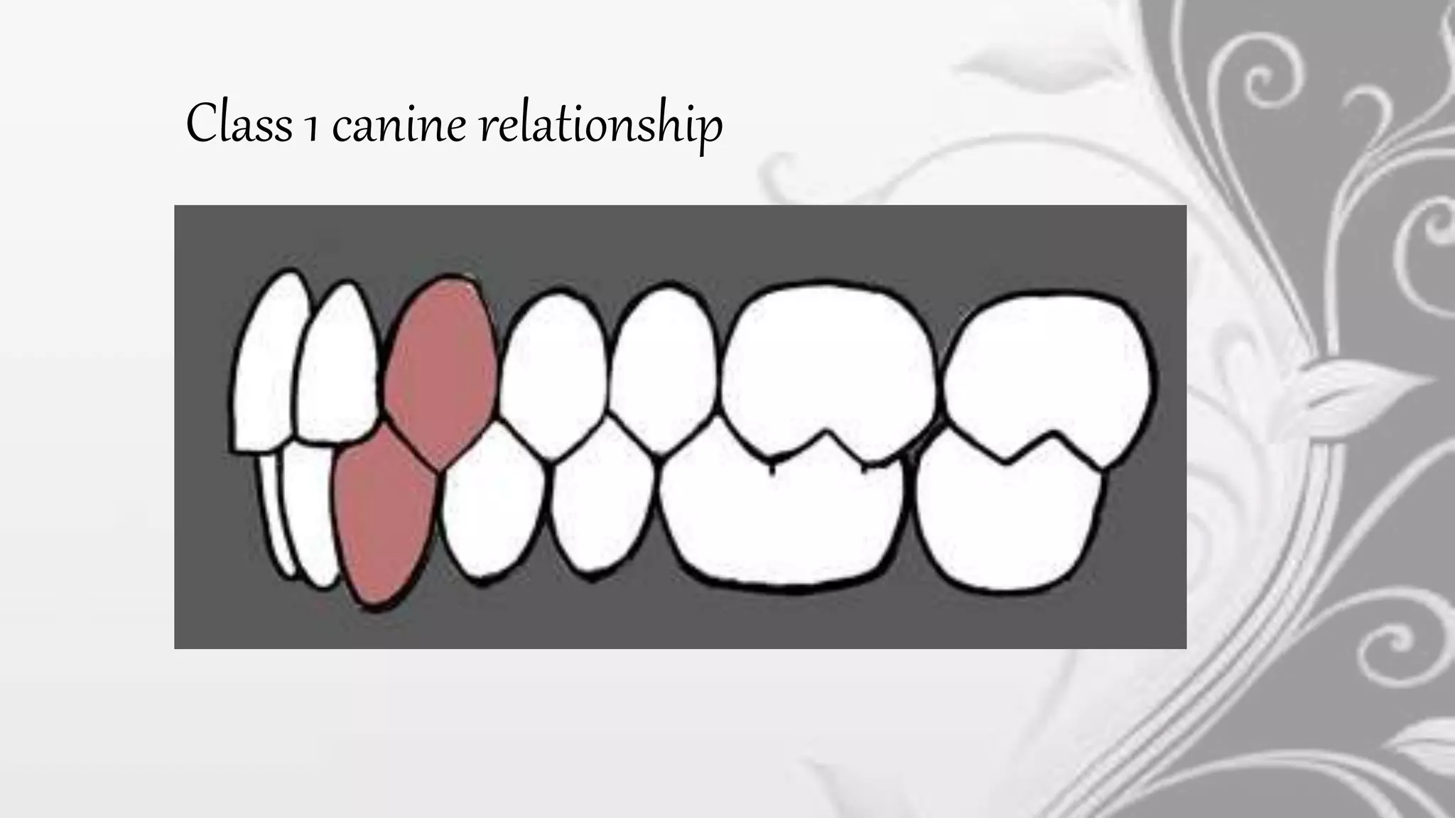 Principles of teeth arrangement and compensatory curves | PPTX