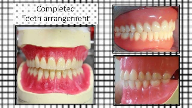 Principles of teeth arrangement and compensatory curves