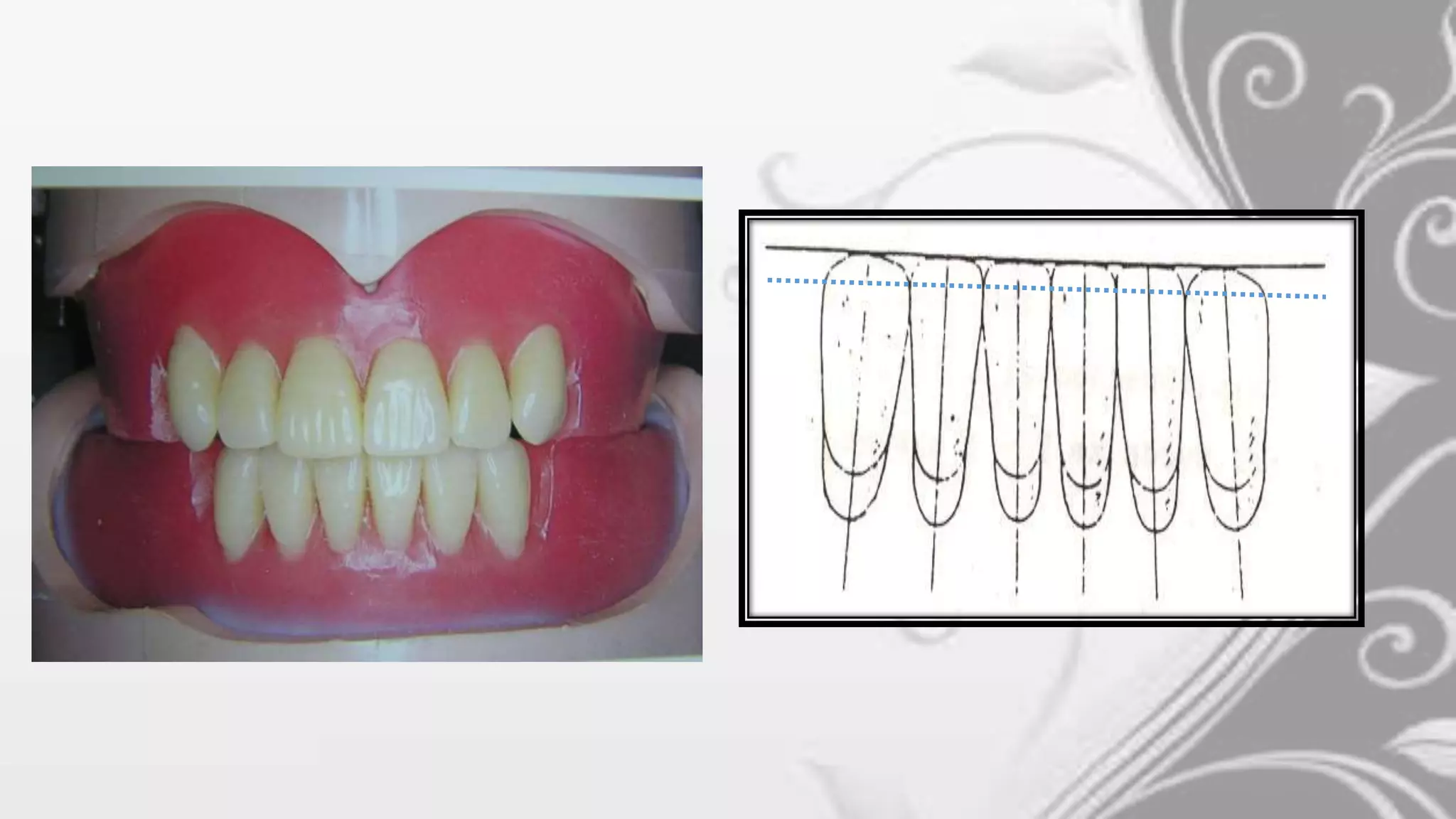 Principles of teeth arrangement and compensatory curves | PPTX