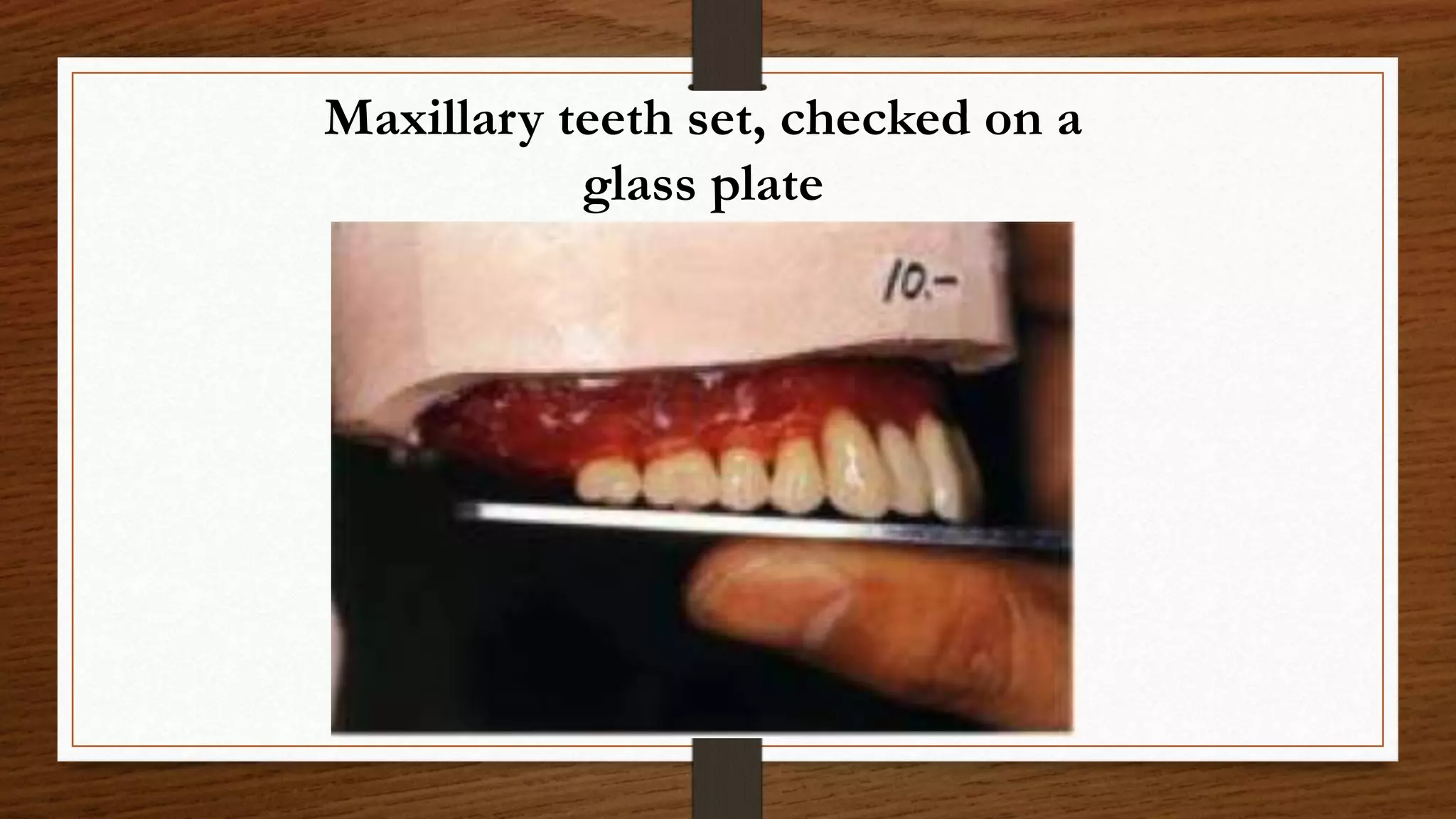 Principles of teeth arrangement and compensatory curves | PPTX