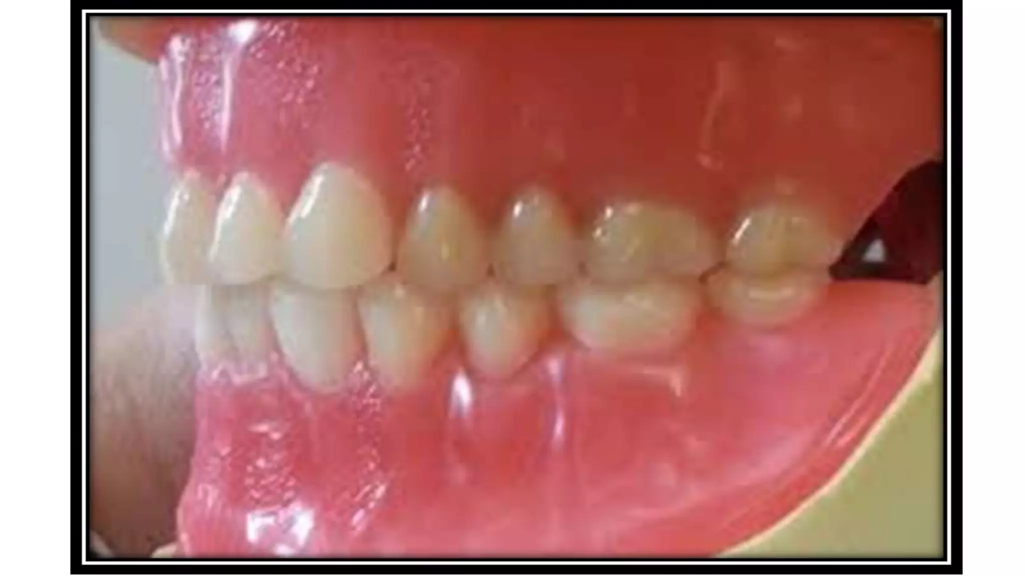 Principles of teeth arrangement and compensatory curves | PPTX