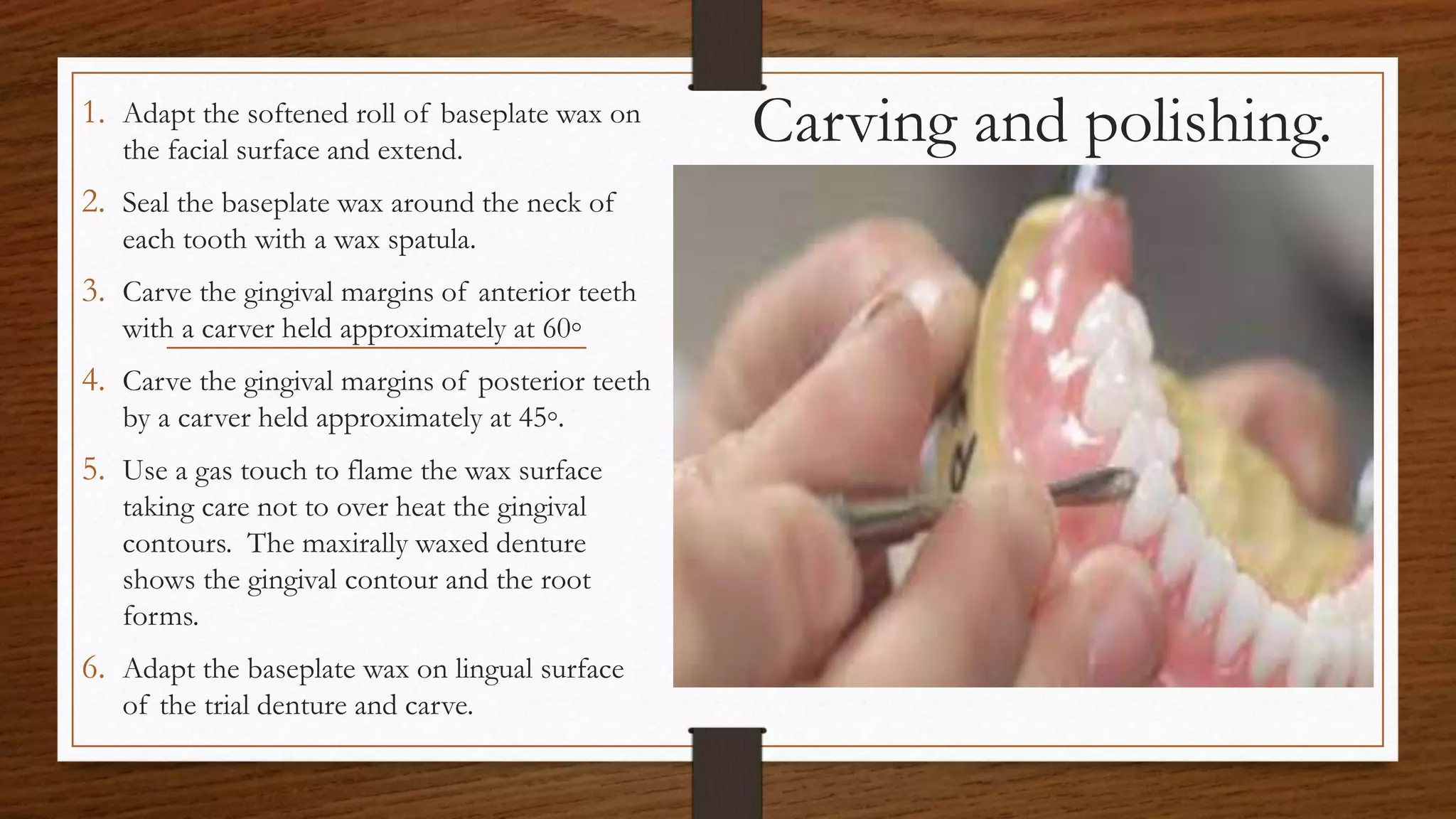 Principles of teeth arrangement and compensatory curves | PPTX