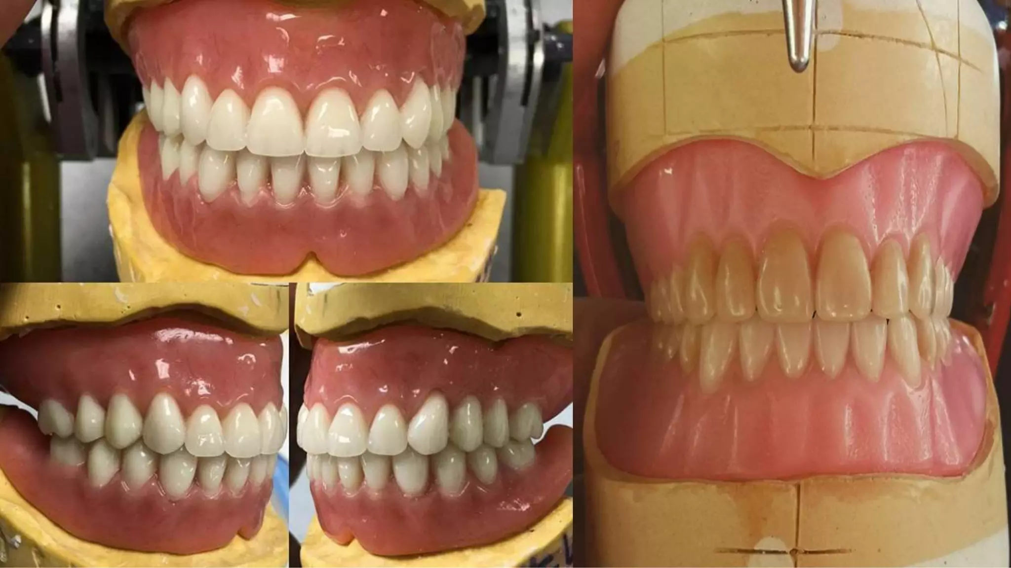 Principles of teeth arrangement and compensatory curves | PPTX