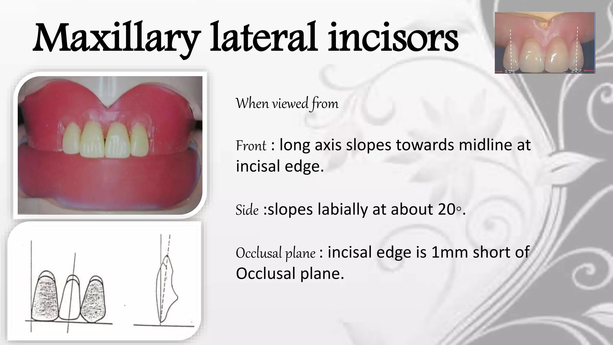 Principles of teeth arrangement and compensatory curves | PPTX
