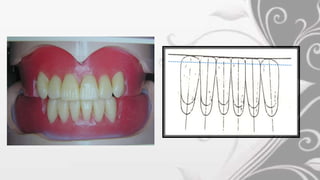 Principles of teeth arrangement and compensatory curves | PPTX
