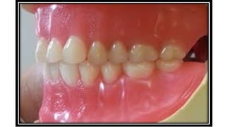 Principles of teeth arrangement and compensatory curves | PPTX