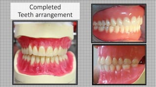 Principles of teeth arrangement and compensatory curves | PPTX