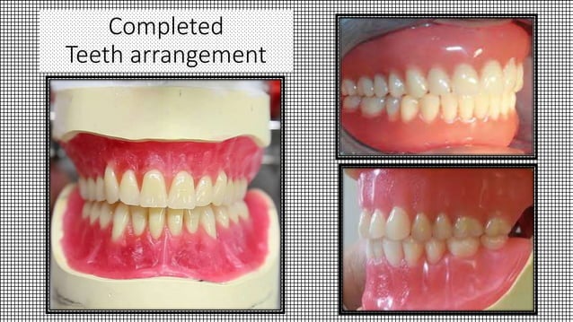 Principles of teeth arrangement and compensatory curves | PPTX