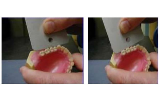 Principles of teeth arrangement and compensatory curves | PPTX