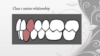 Principles of teeth arrangement and compensatory curves | PPTX