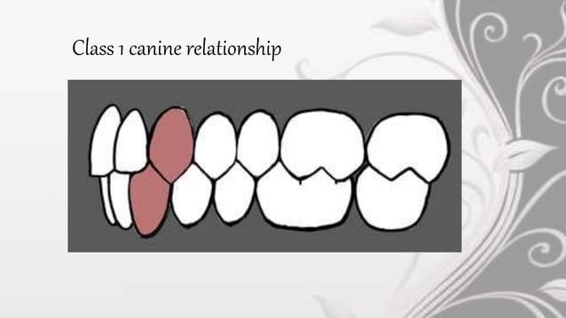 Principles of teeth arrangement and compensatory curves | PPTX