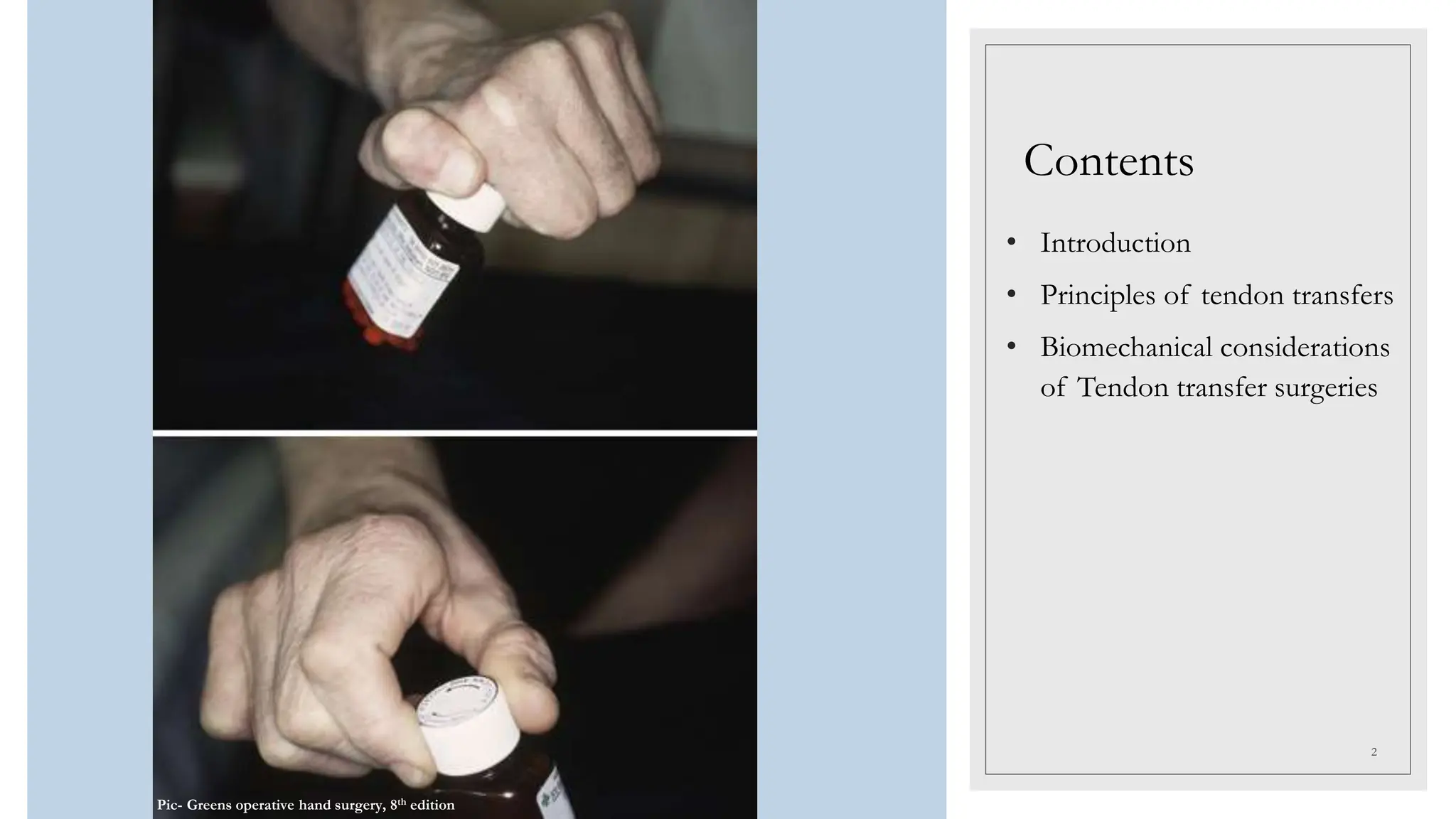 Principles of tendon transfer surgeries in rehabilitation | PPTX