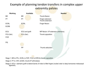 Principles of tendon transfersw | PPT