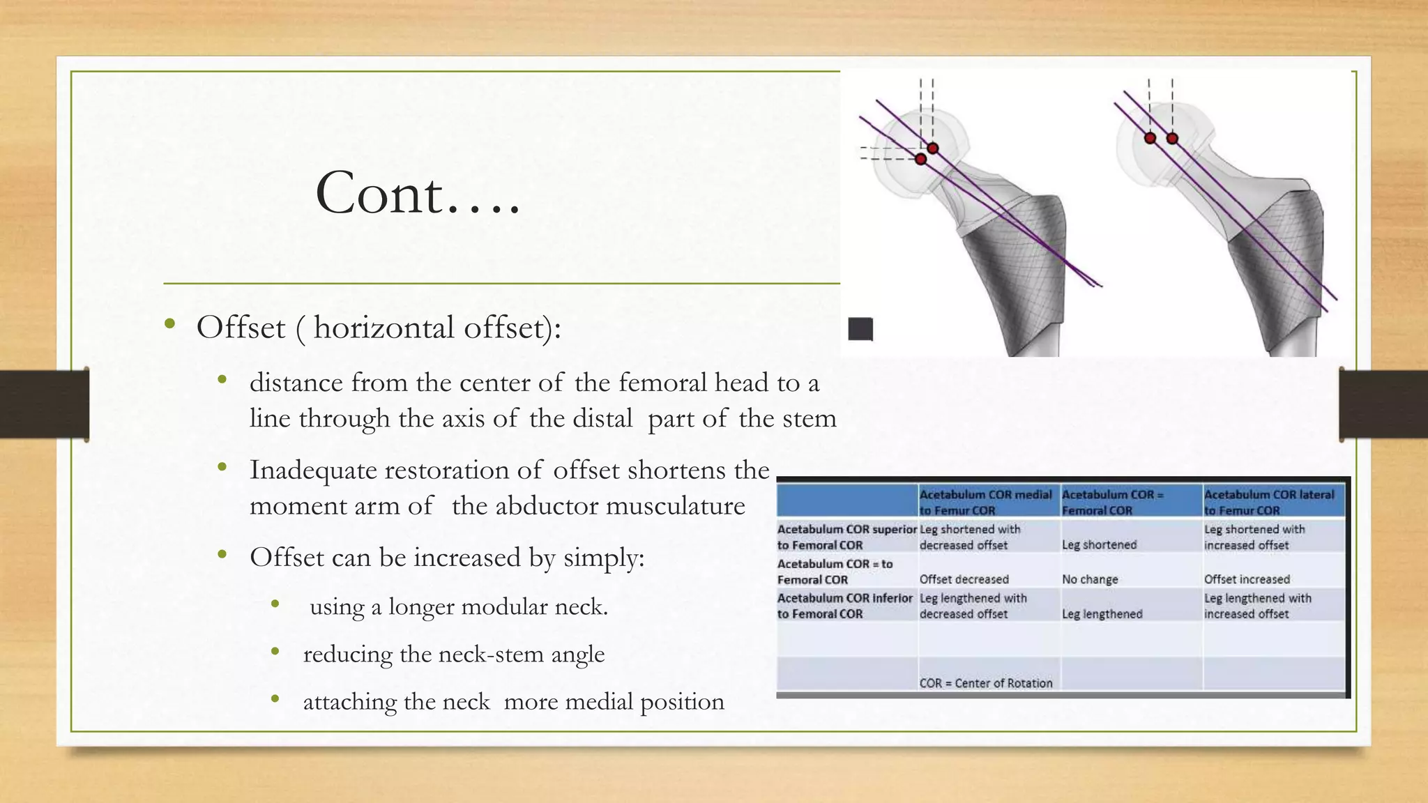 Principles Of Total Hip Replacement | PPTX