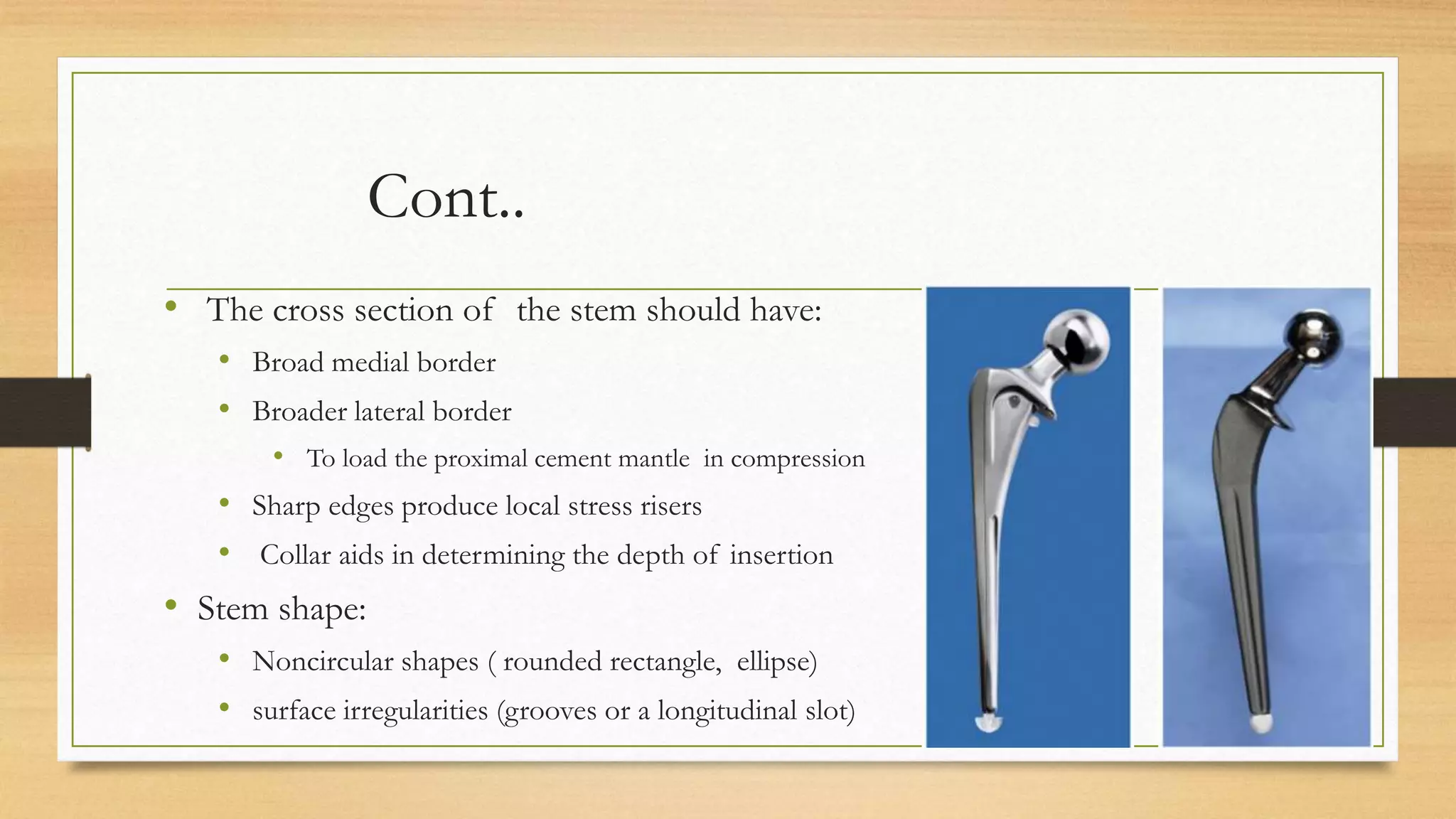 Principles Of Total Hip Replacement | PPTX