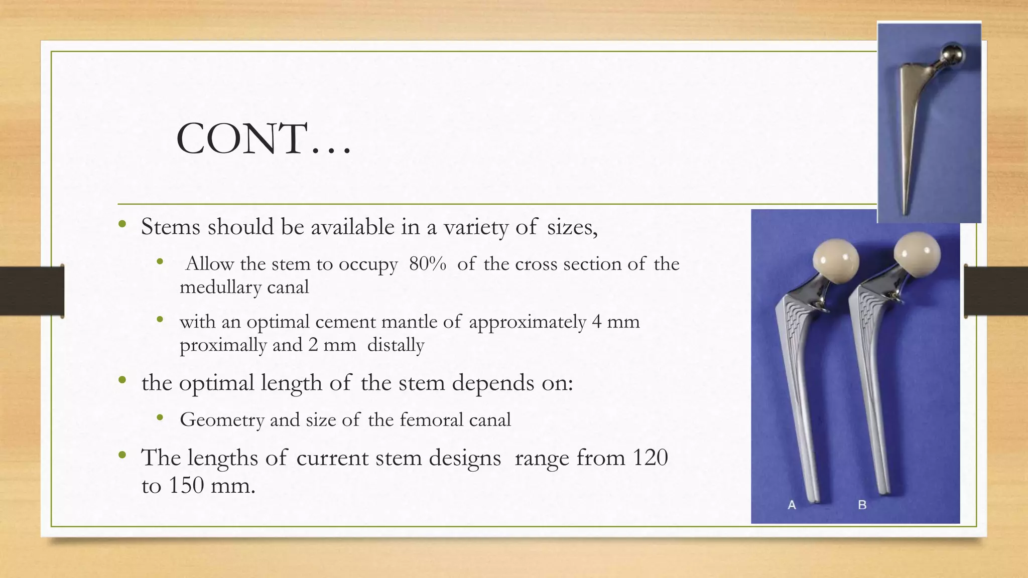 Principles Of Total Hip Replacement | PPTX