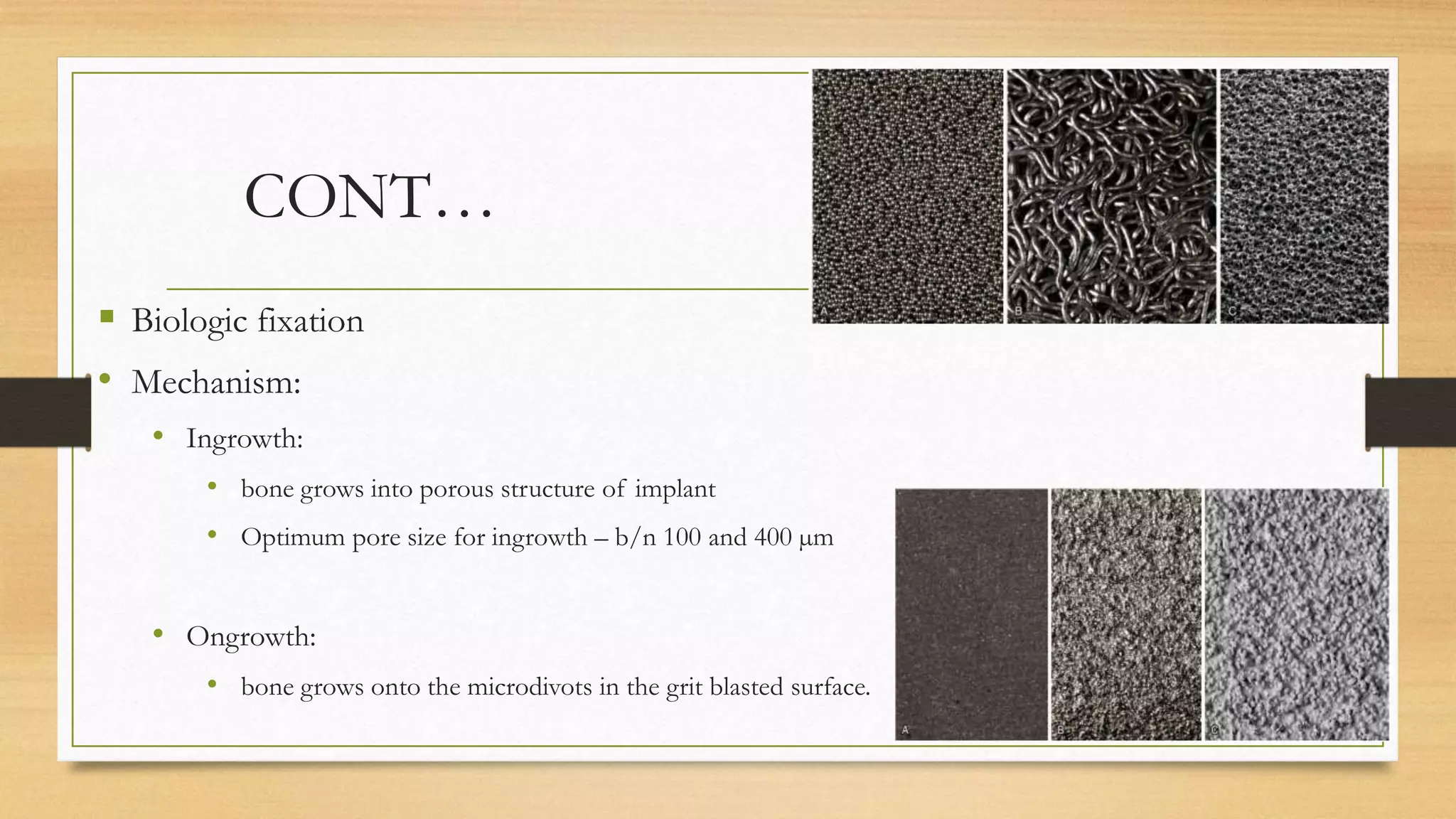 Principles Of Total Hip Replacement | PPTX