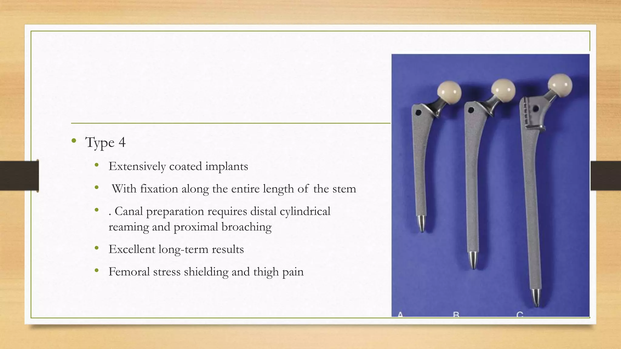 Principles Of Total Hip Replacement | PPTX