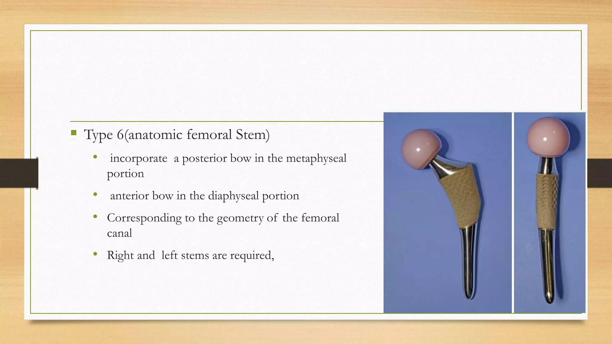 Principles Of Total Hip Replacement | PPTX