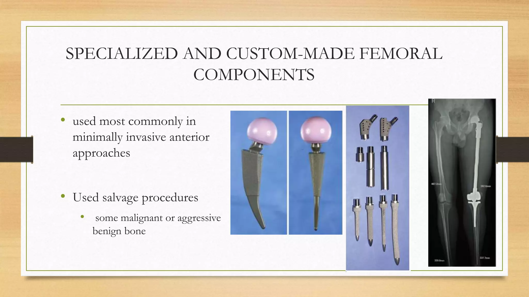 Principles Of Total Hip Replacement | PPTX