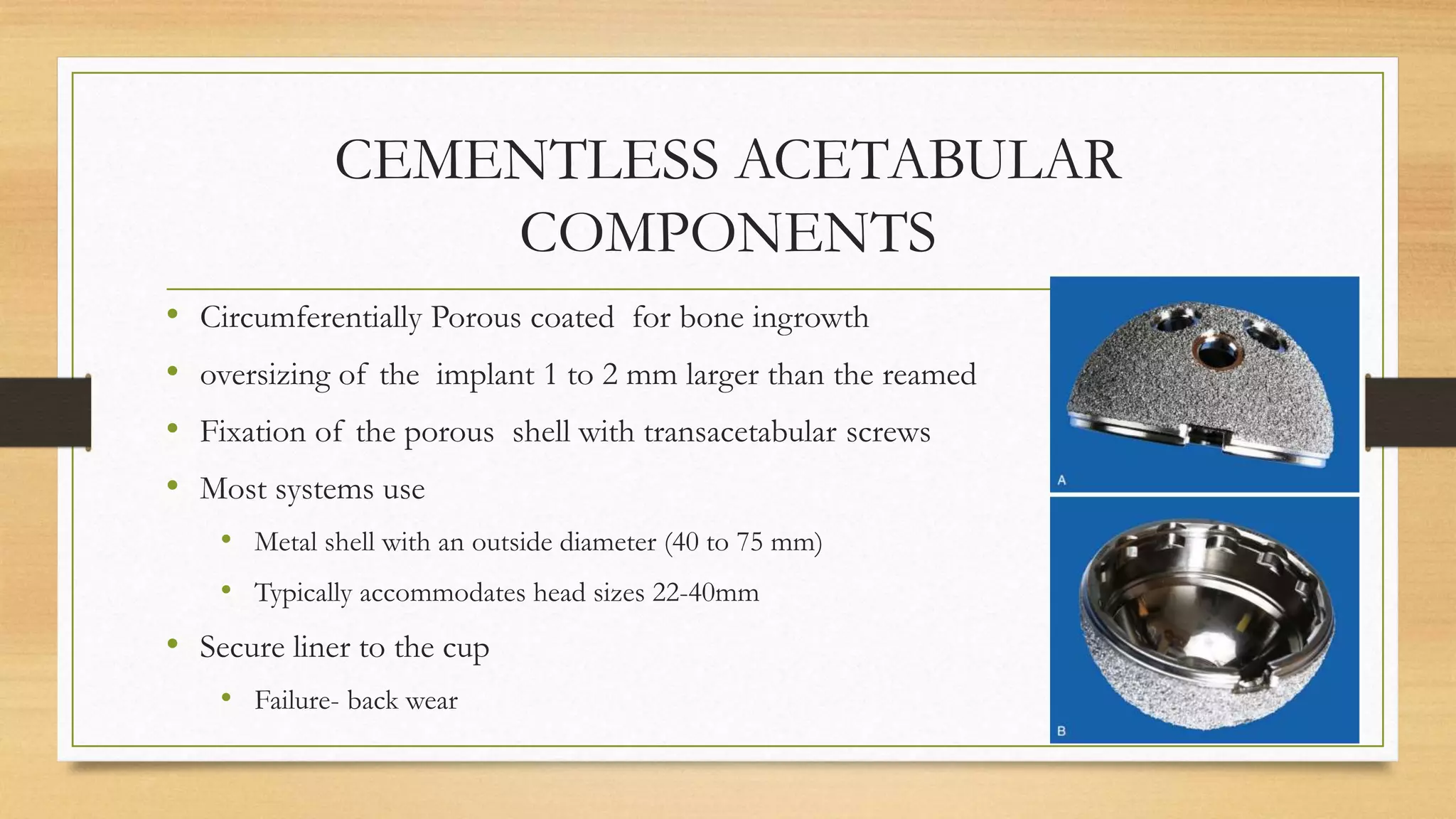 Principles Of Total Hip Replacement | PPTX