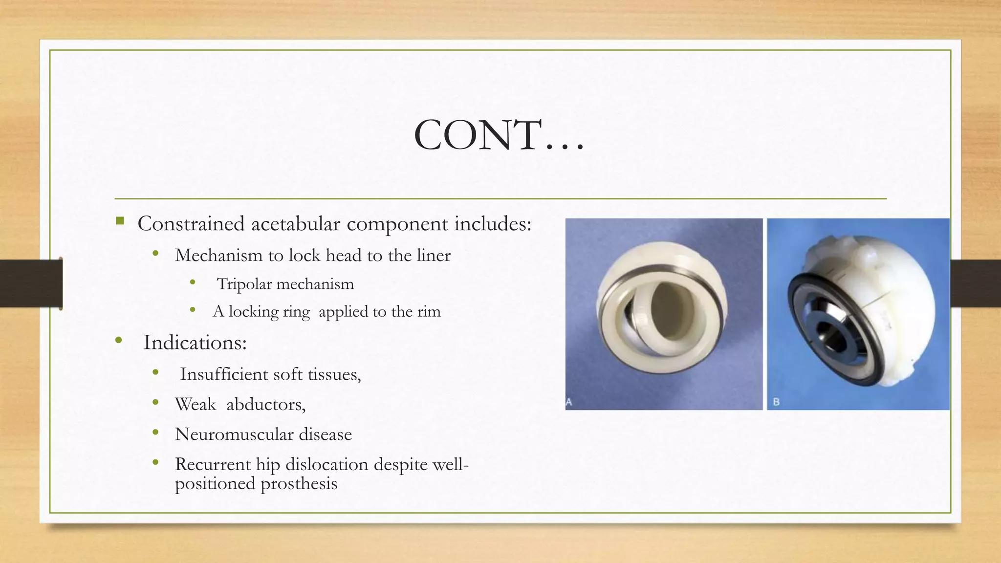 Principles Of Total Hip Replacement | PPTX