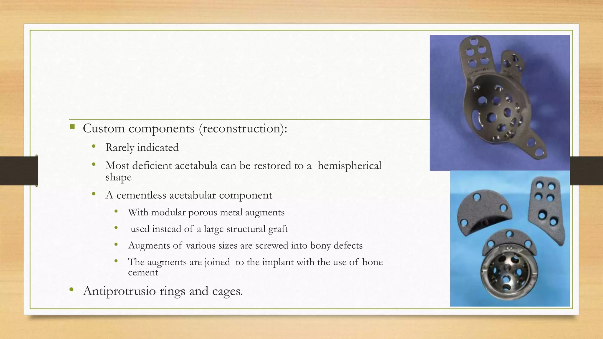 Principles Of Total Hip Replacement | PPTX