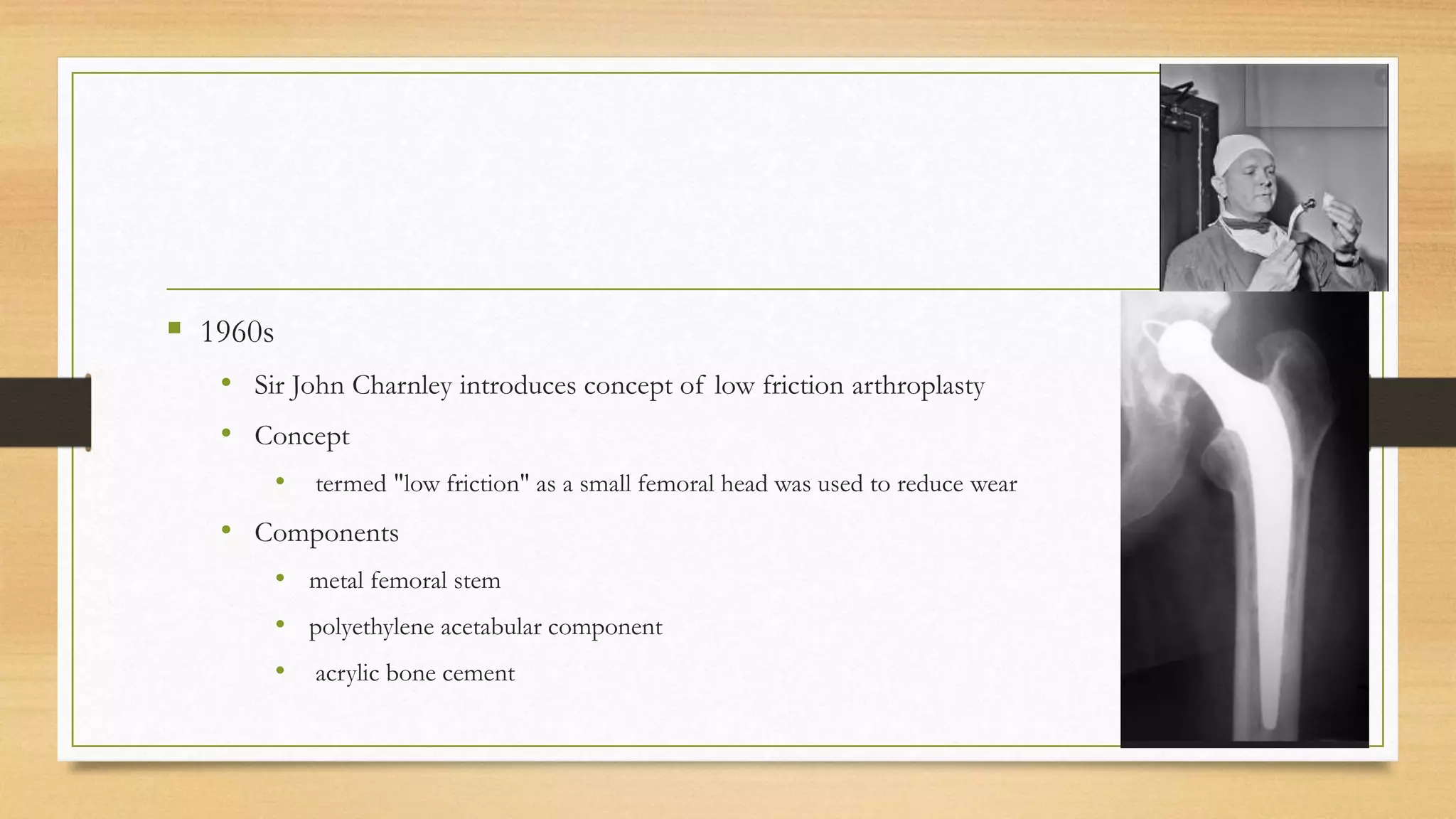 Principles Of Total Hip Replacement | PPTX