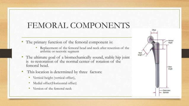 Principles Of Total Hip Replacement | PPTX