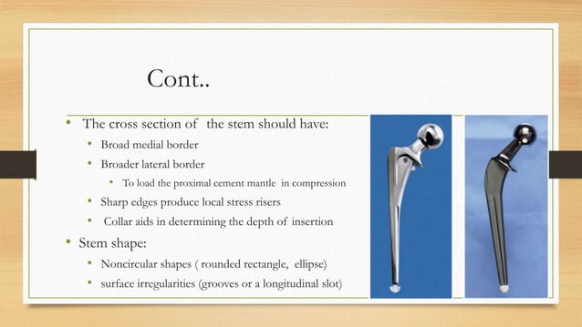 Principles Of Total Hip Replacement | PPTX