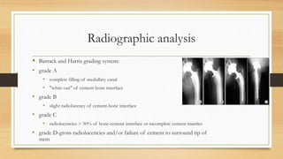 Principles Of Total Hip Replacement | PPTX