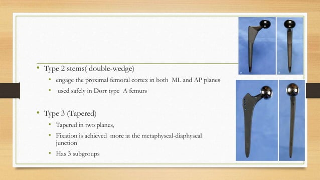 Principles Of Total Hip Replacement | PPTX