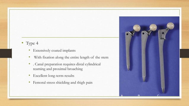 Principles Of Total Hip Replacement | PPTX