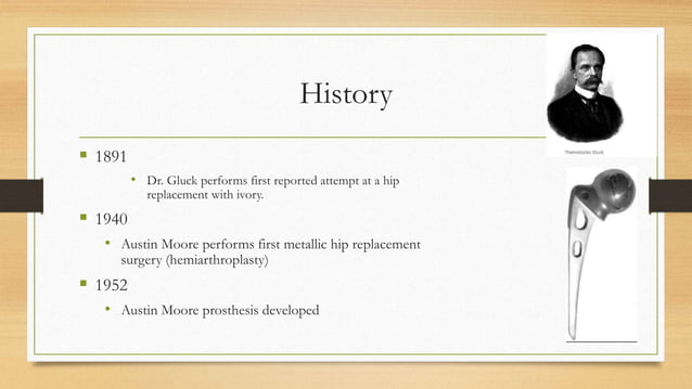 Principles Of Total Hip Replacement | PPTX