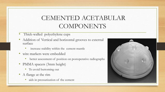 Principles Of Total Hip Replacement | PPTX