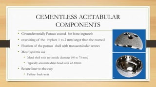 Principles Of Total Hip Replacement | PPTX