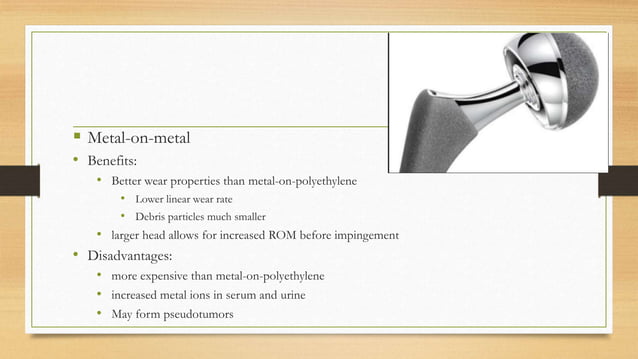 Principles Of Total Hip Replacement | PPTX