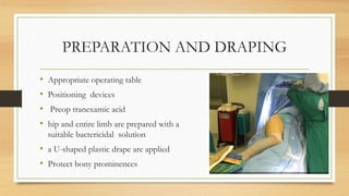 Principles Of Total Hip Replacement | PPTX